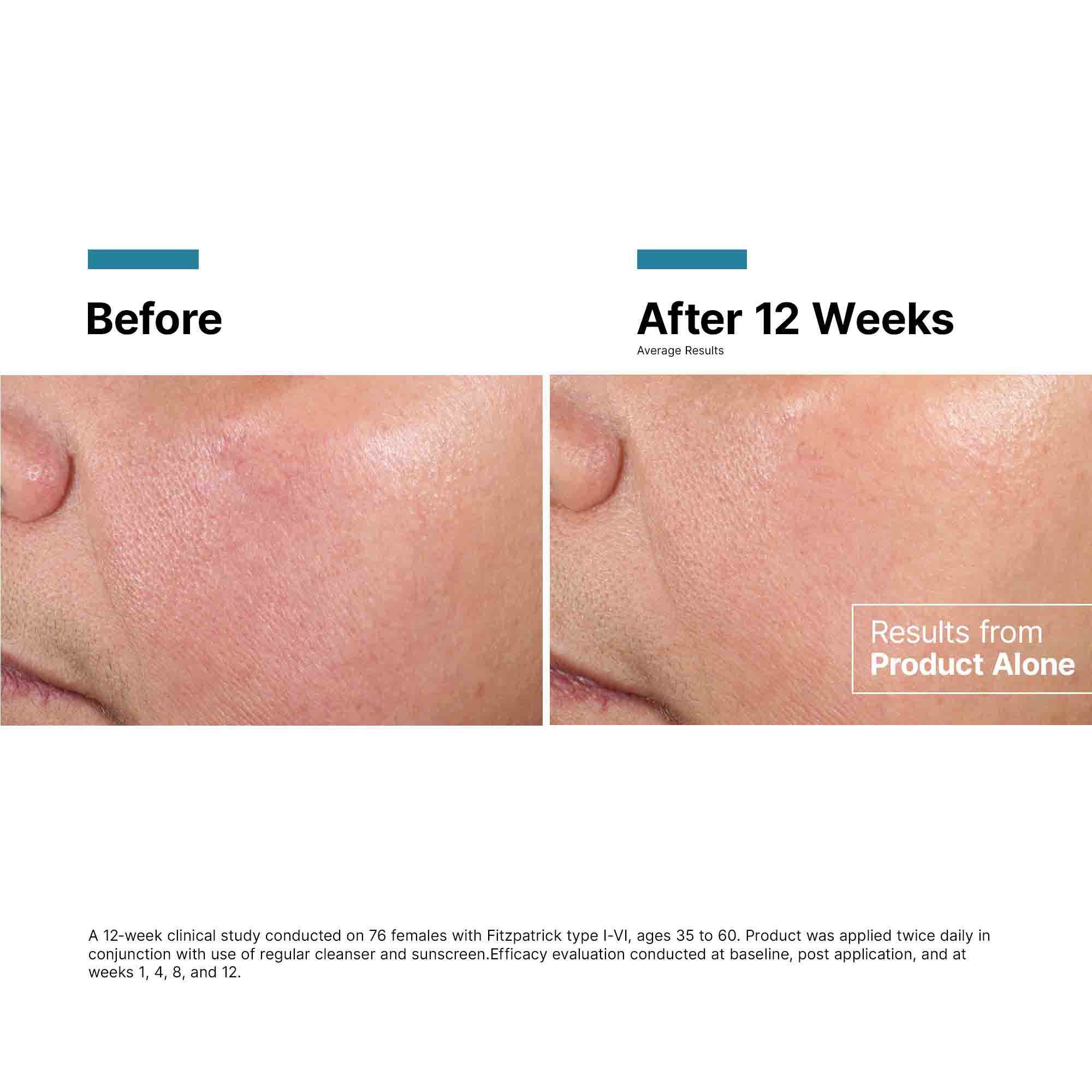 SkinCeuticals Advanced RGN-6: The Revolutionary Skin Regeneration ...